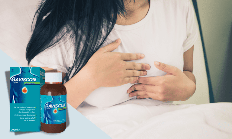 Top Gaviscon Alternatives: My Personal Picks